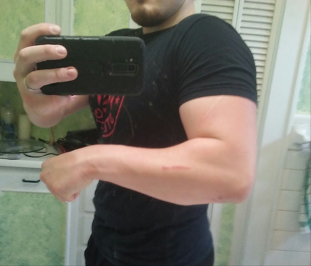 Forearm/Weight loss progress. - #156442785 added by studbeefpile at ...