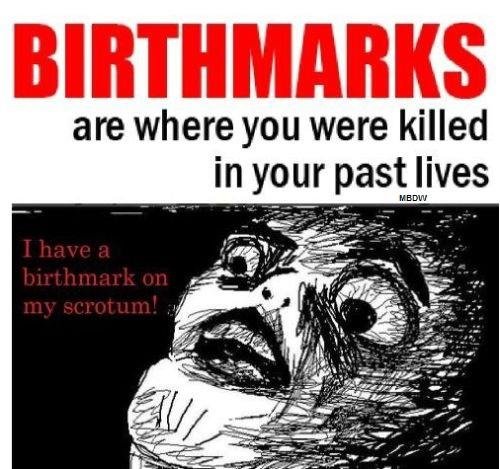 Birthmarks